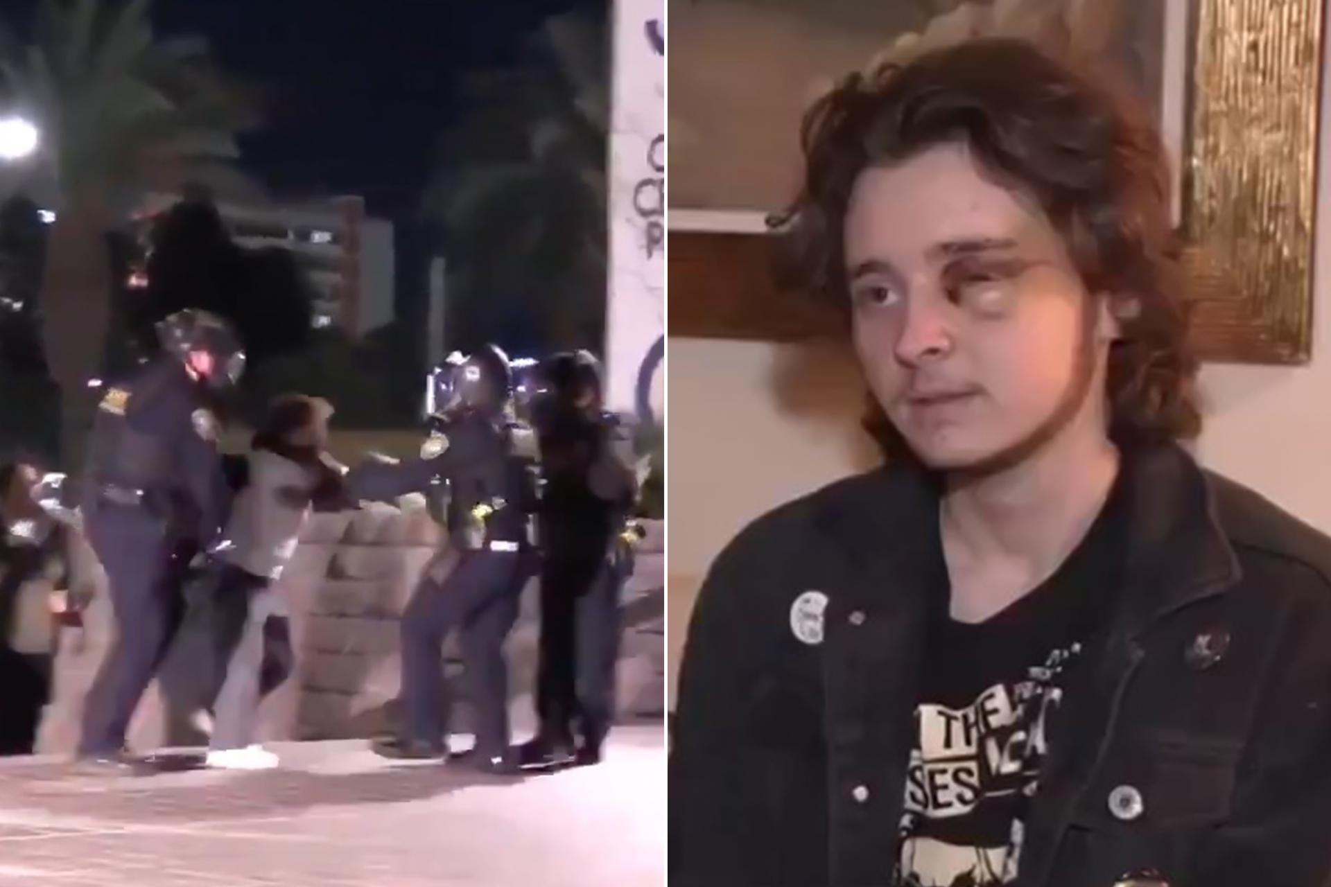 Protester Loses Eye After Incident at Immigration Protest in California ...